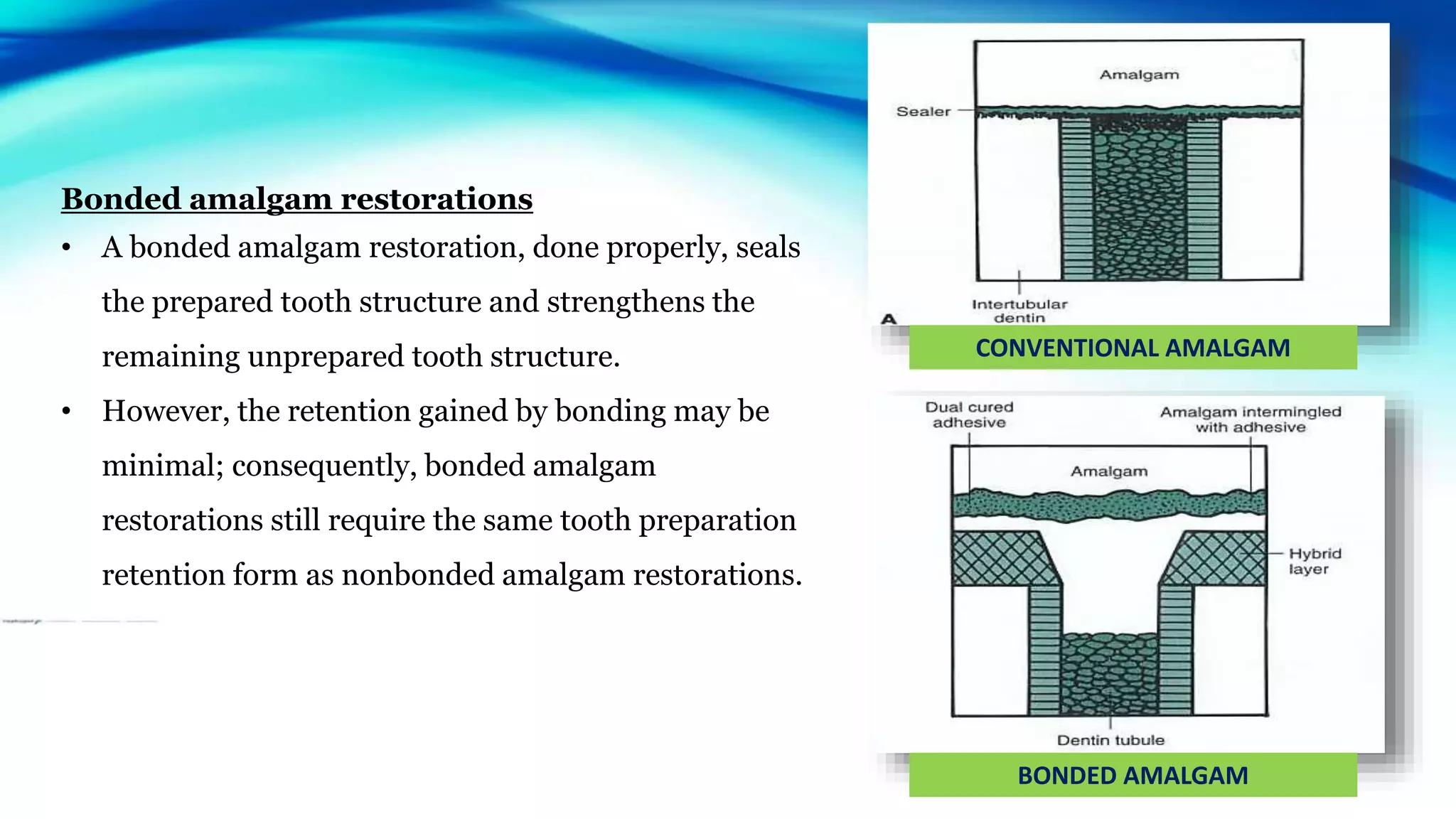 AMALGAM CAVITY PREPARATION | PPTX