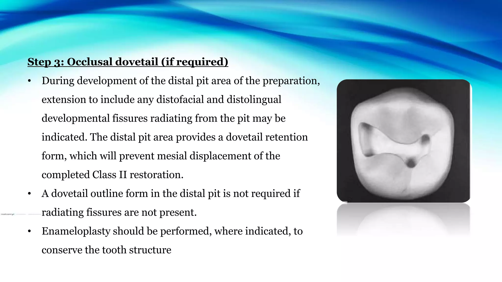 AMALGAM CAVITY PREPARATION | PPTX