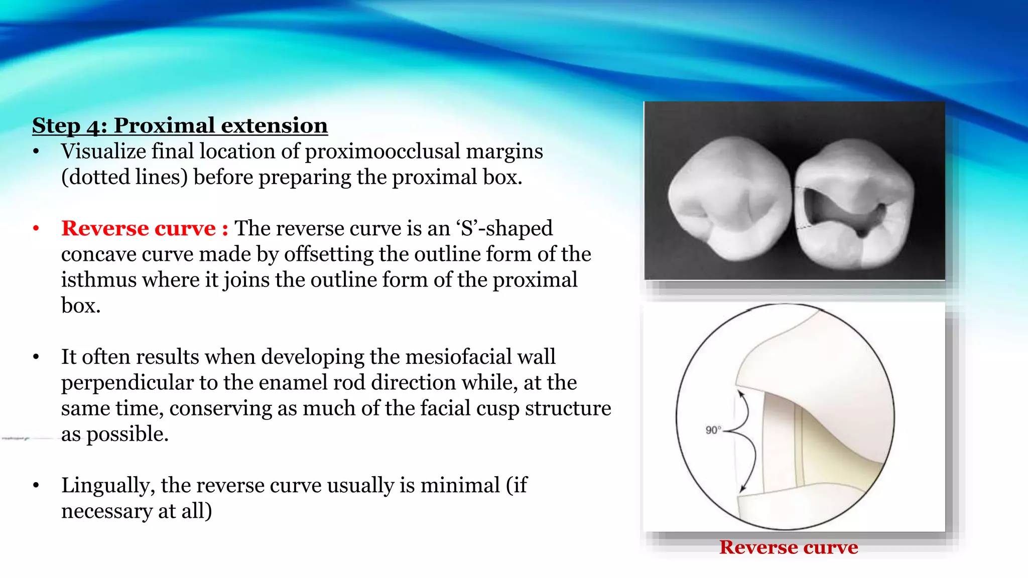 AMALGAM CAVITY PREPARATION | PPTX
