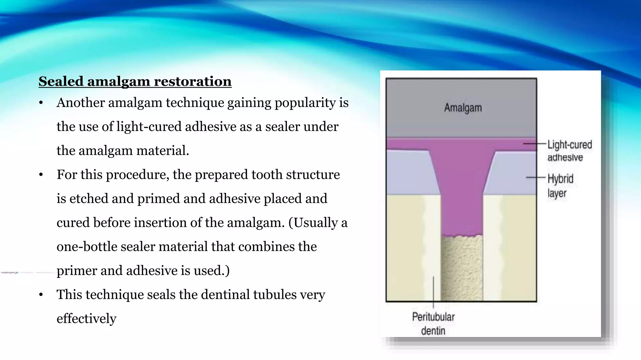 AMALGAM CAVITY PREPARATION | PPTX