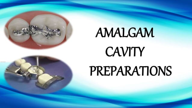 AMALGAM CAVITY PREPARATION | PPTX