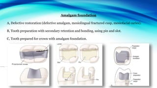 AMALGAM CAVITY PREPARATION | PPTX