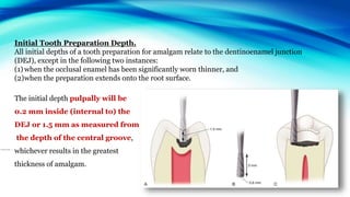 AMALGAM CAVITY PREPARATION | PPTX