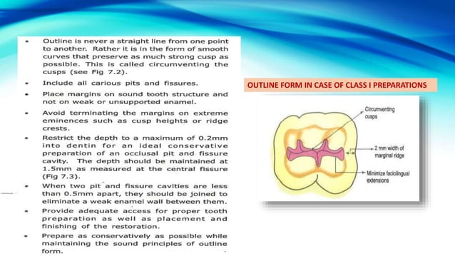 AMALGAM CAVITY PREPARATION | PPTX