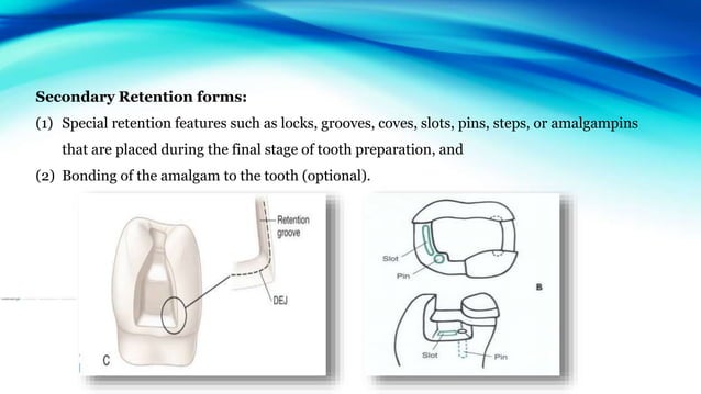 AMALGAM CAVITY PREPARATION | PPTX