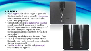 AMALGAM CAVITY PREPARATION | PPTX