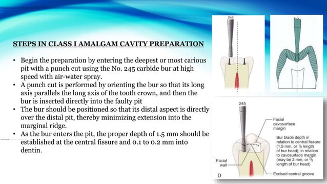 AMALGAM CAVITY PREPARATION | PPTX