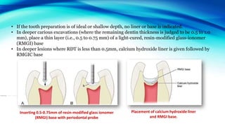 AMALGAM CAVITY PREPARATION | PPTX
