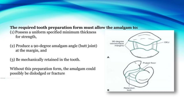 AMALGAM CAVITY PREPARATION | PPTX