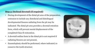 AMALGAM CAVITY PREPARATION | PPTX