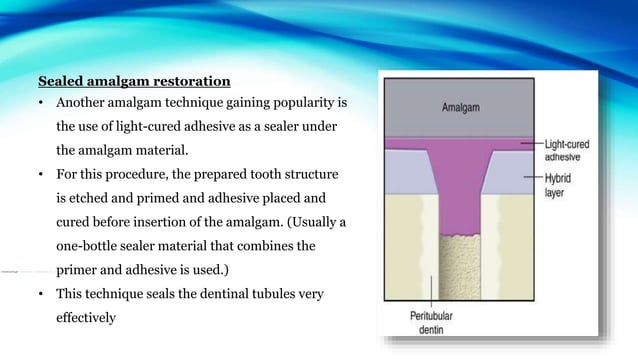 AMALGAM CAVITY PREPARATION | PPTX