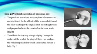 AMALGAM CAVITY PREPARATION | PPTX
