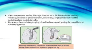 AMALGAM CAVITY PREPARATION | PPTX