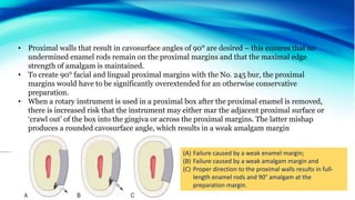 AMALGAM CAVITY PREPARATION | PPTX