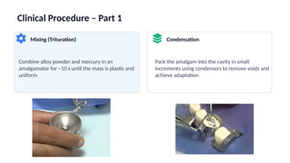 amalgam restorations basics cavity design | PPTX
