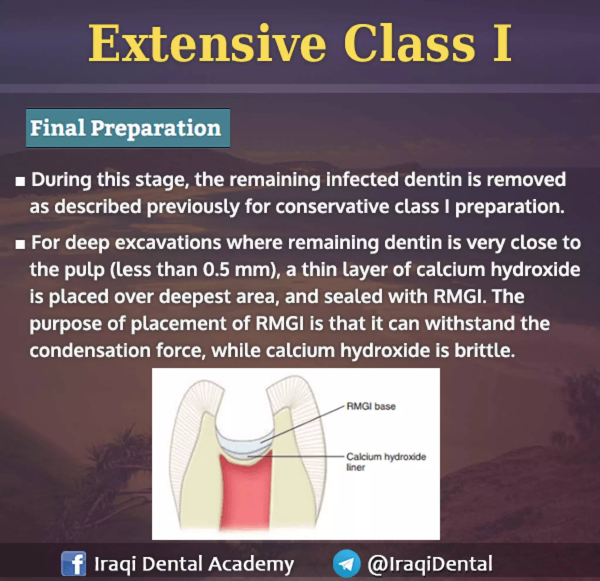 Amalgam Class I Restoration Explained | PDF