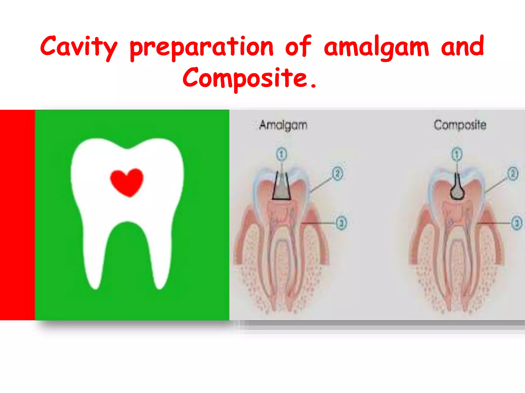 Amalgam &composite | PPTX