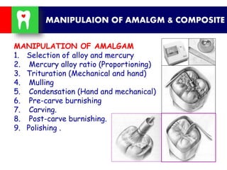 Amalgam &composite | PPTX