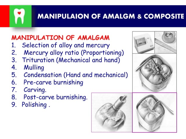 Amalgam &composite | PPTX