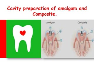 Amalgam &composite | PPTX