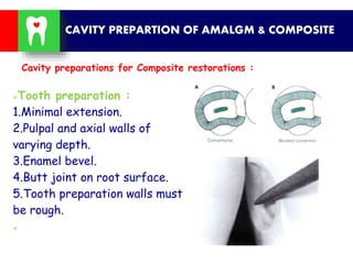 Amalgam &composite | PPTX
