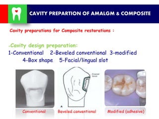 Amalgam &composite | PPTX