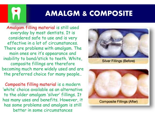 Amalgam &composite | PPTX
