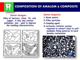 Amalgam &composite | PPTX