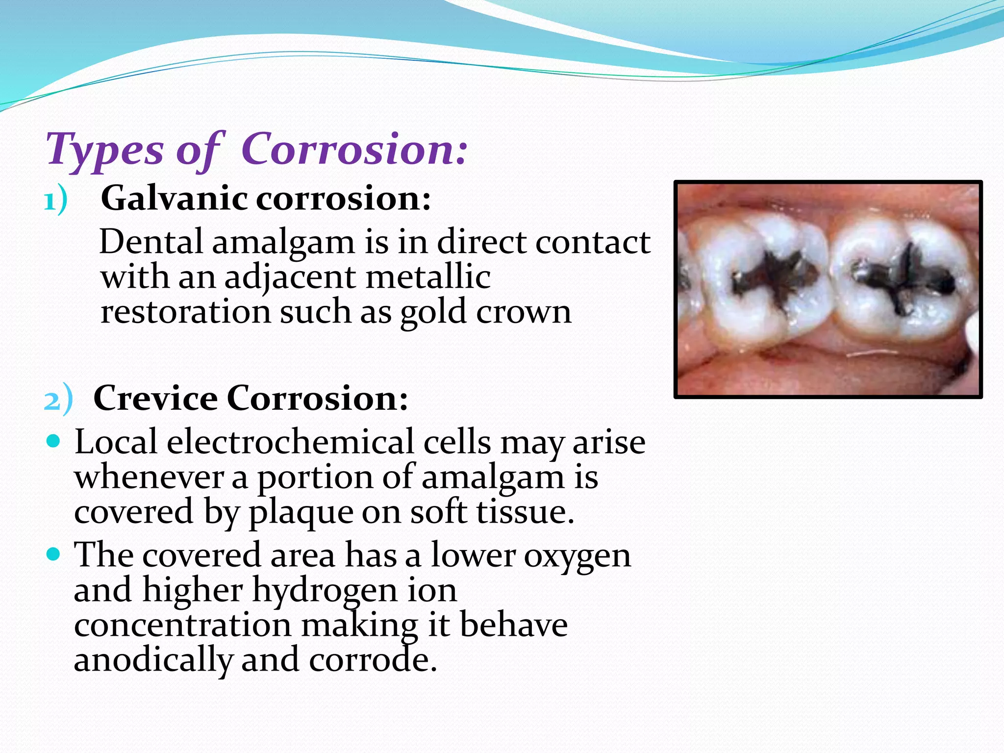 Dental Amalgam | PPTX