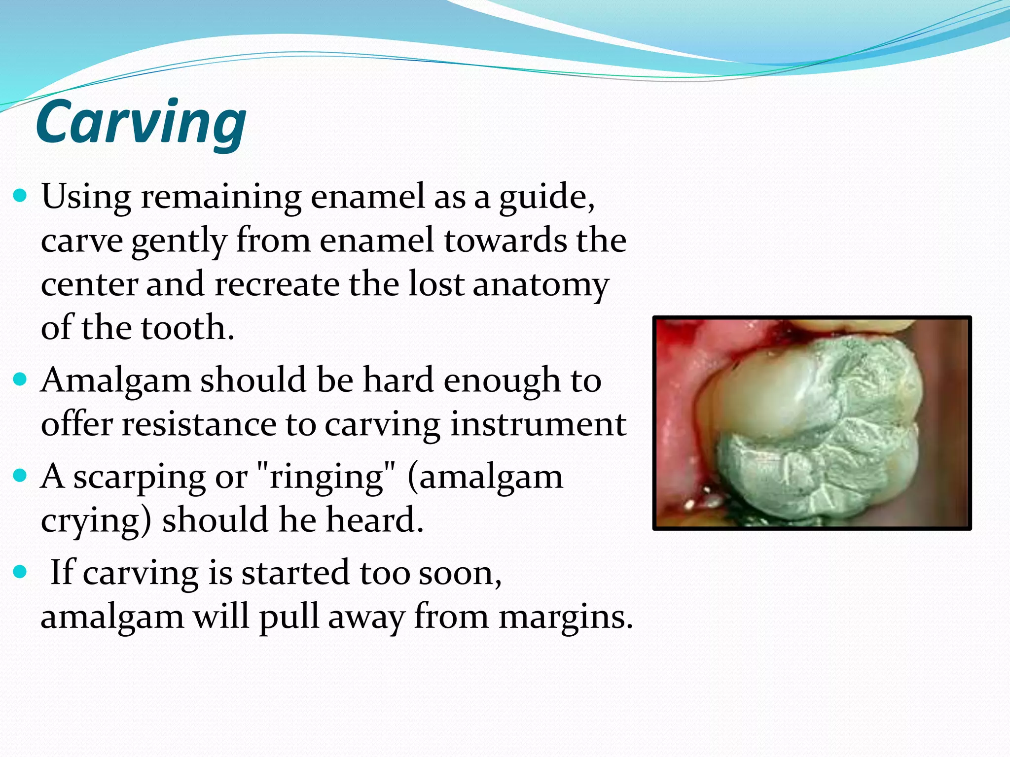 Dental Amalgam | PPTX