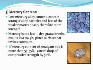 Dental Amalgam | PPTX