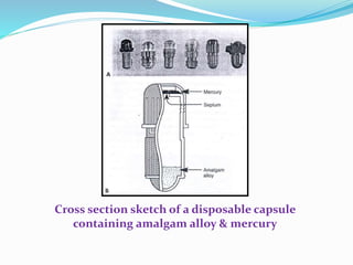 Dental Amalgam | PPTX