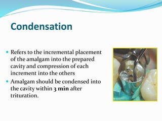 Dental Amalgam | PPTX