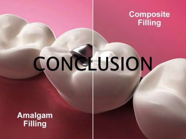 Amalgam vs composites | PPTX | Oral care | Personal Care