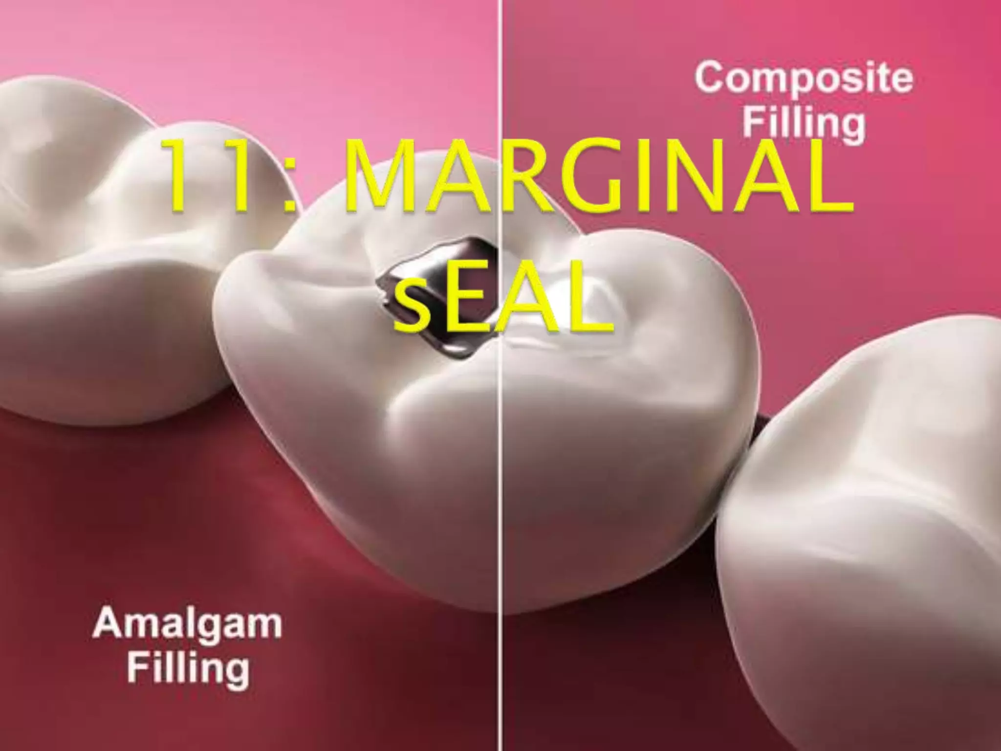 Amalgam vs composites by Dr Rashid Hassan | PPTX