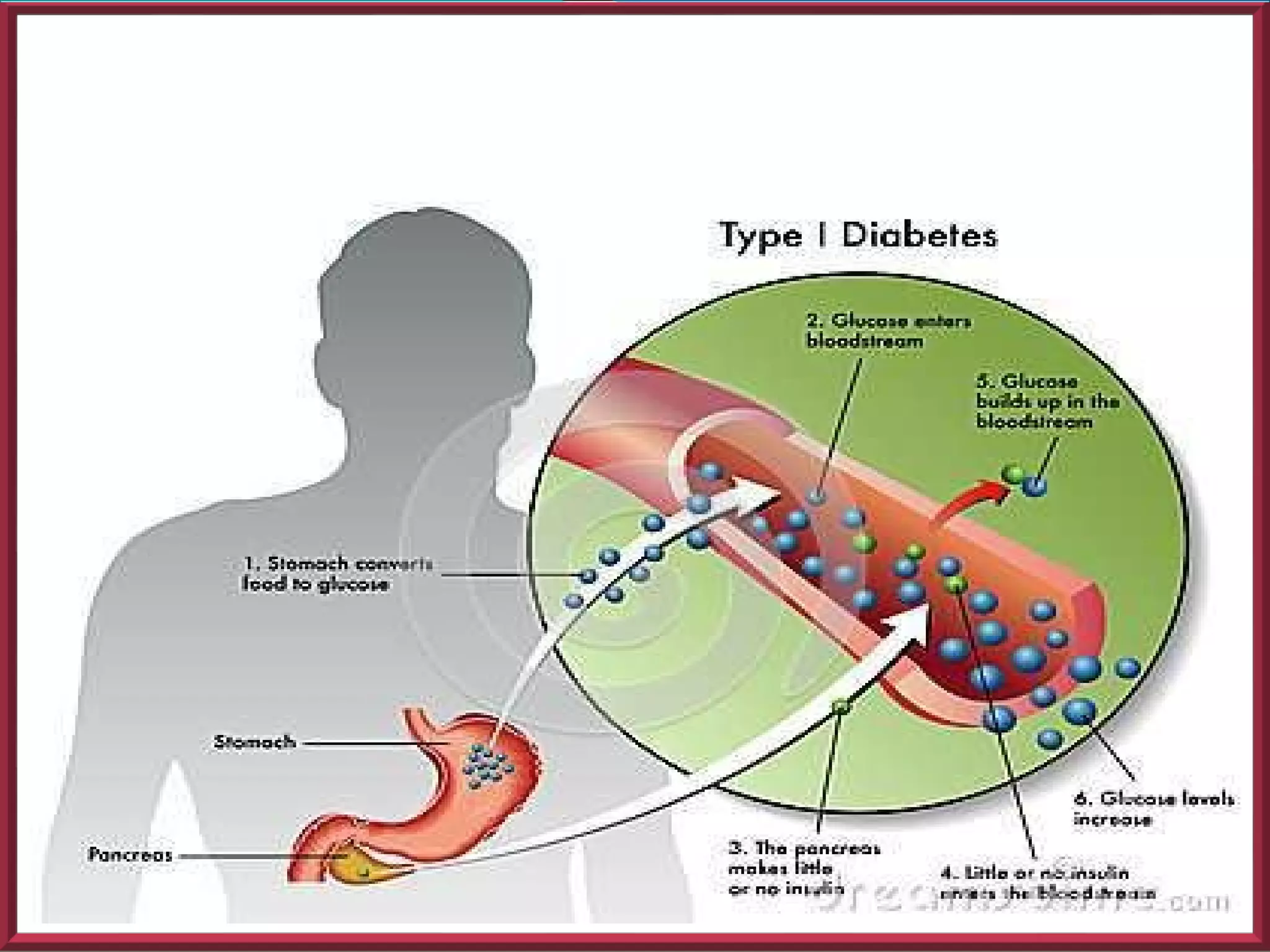Diabetes Mellitus | PPT