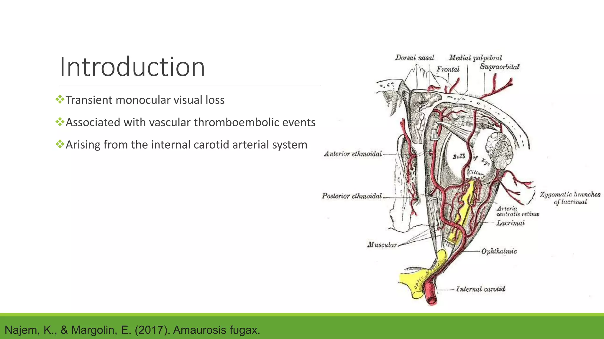 Amaurosis Fugax | PPTX
