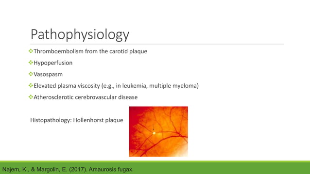 Amaurosis Fugax | PPTX | Eye and Vision Conditions | Diseases and ...