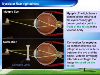 Amazing Human Eye | PPTX