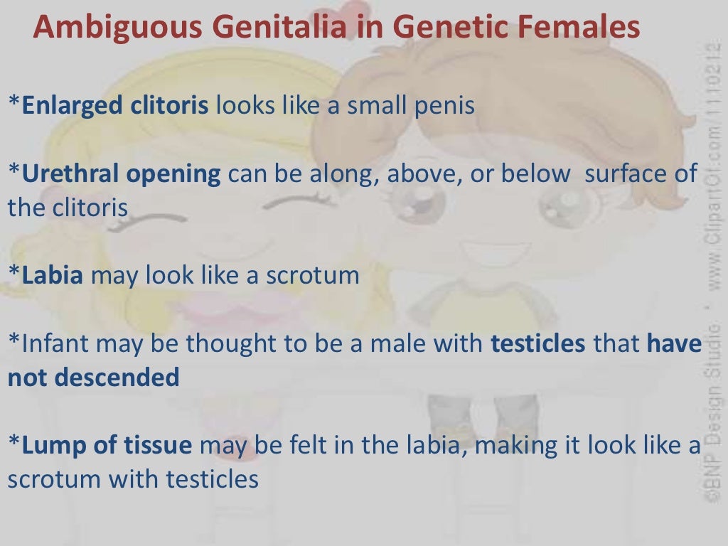 Ambiguous genitalia .....