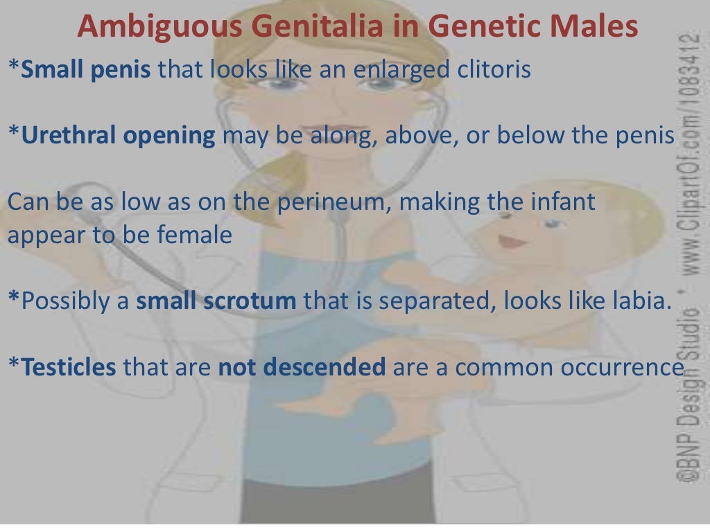 Ambiguous genitalia .....