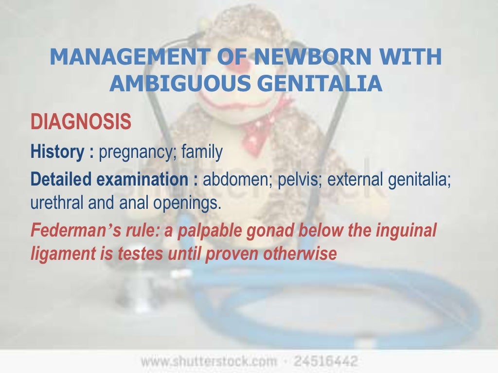 Ambiguous genitalia .....