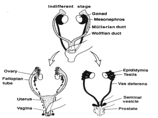 Ambiguous genitalia | PPT