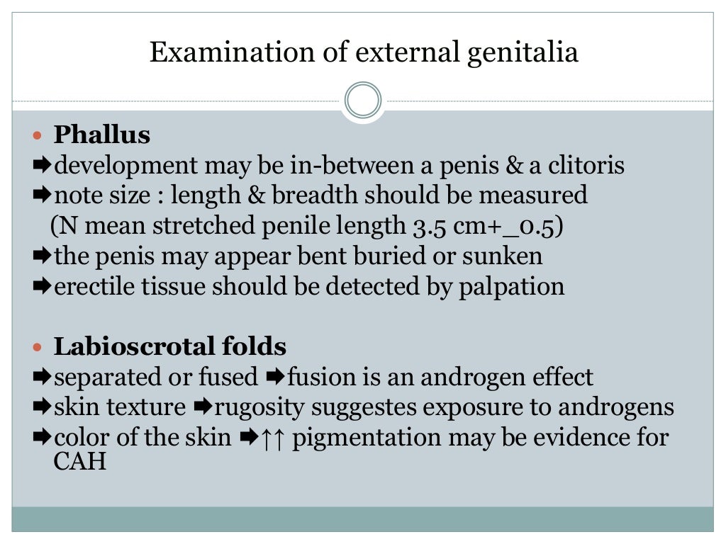 Ambiguous genitalia