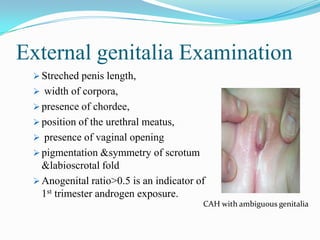 Ambiguousgenitalia ppt | PPT