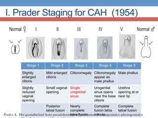 ambiguous genitalia | PDF