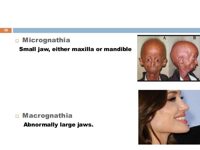 Ambili face development