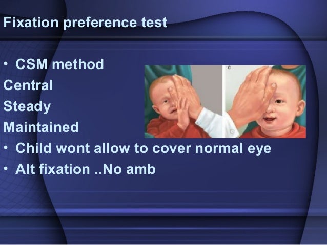 Amblyopia