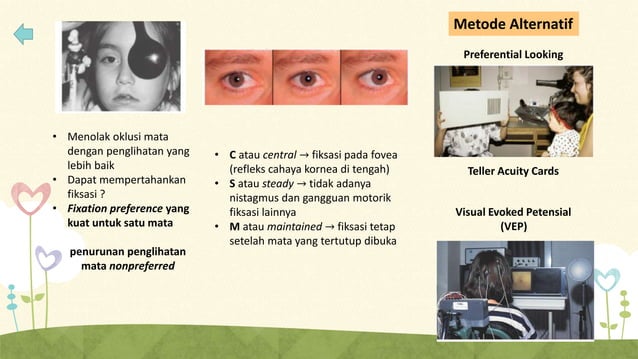 Amblyopia DNP | PPTX