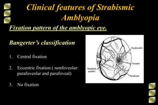 Amblioppia and it's management | PPTX
